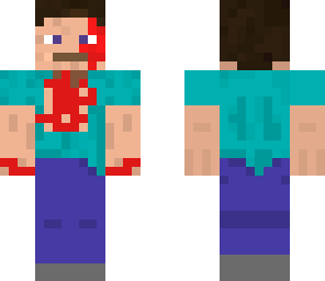 Hurt Steve | Minecraft Skins