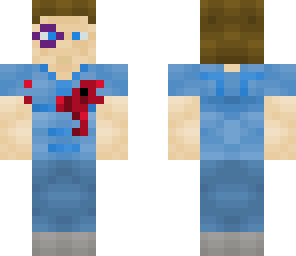 Hurt steve | Minecraft Skin