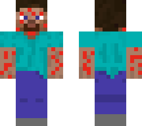 Steve with chicken pox | Minecraft Skin