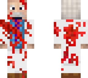 Dr. Coomer After Trying to Crawl Into Gordon's Dreams in Act 3 Ep 1 ...