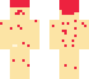 disease | Minecraft Skin