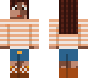Vitiligo is beautiful | Minecraft Skin