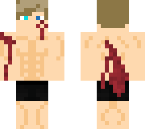 bleeding boy | Minecraft Skin