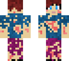 Scars | Minecraft Skin