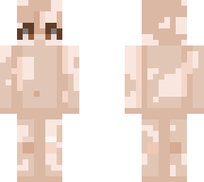 vitiligo | Minecraft Skins