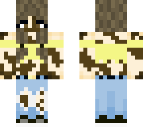 vitiligo | Minecraft Skins