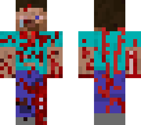 EXTREMELY injured steve | Minecraft Skin