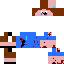 Injured noob in drippy pants | Minecraft Skin